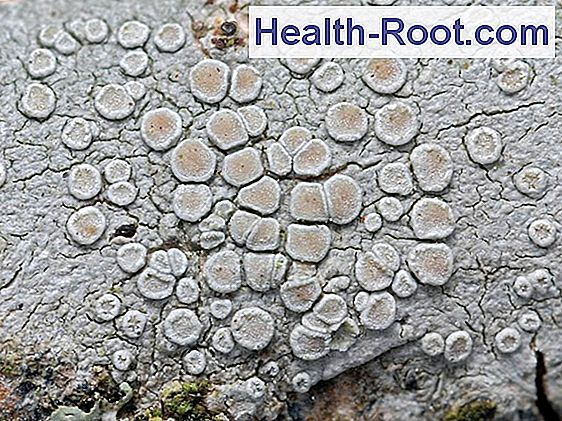 Lichen Sclerosis คืออะไร? 🏥 โรคอาการการรักษา. 2025